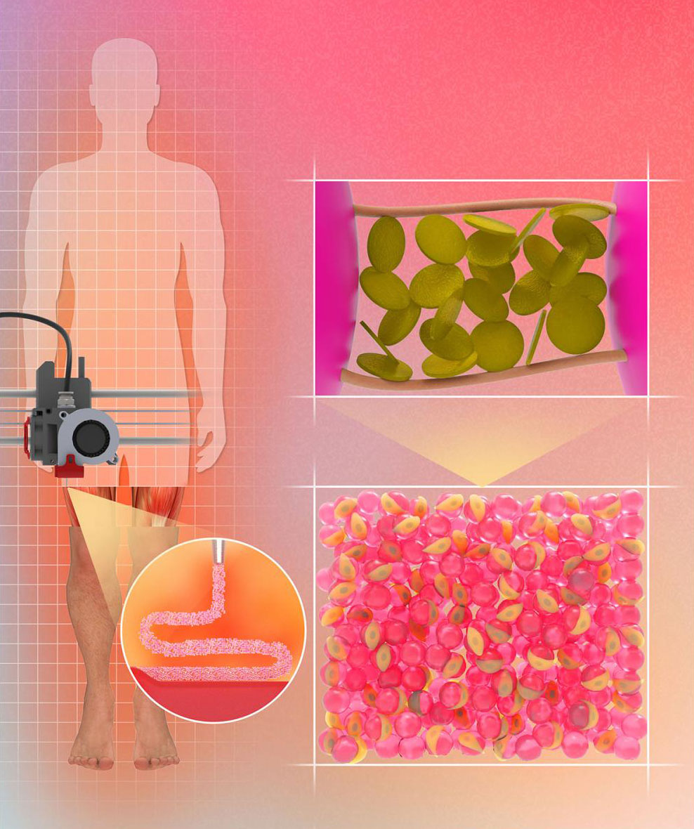 New Granular Hydrogel Bioink Could Expand Possibilities For Tissue New Granular Hydrogel Bioink Could Expand Possibilities For Tissue